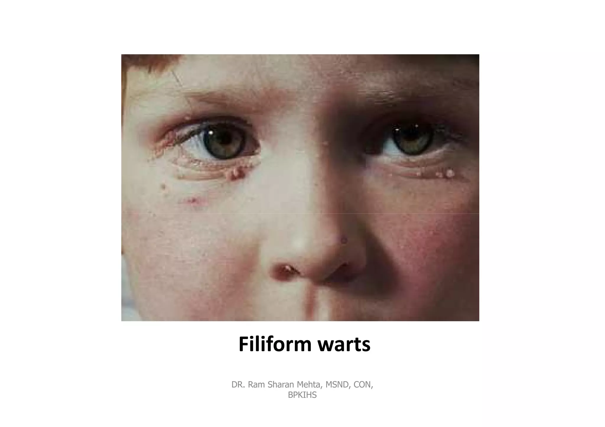 1.1.2. viral infections of skin [compatibility mode] | PDF