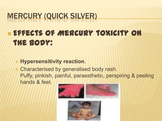Mercury Poisoning Skin Rash