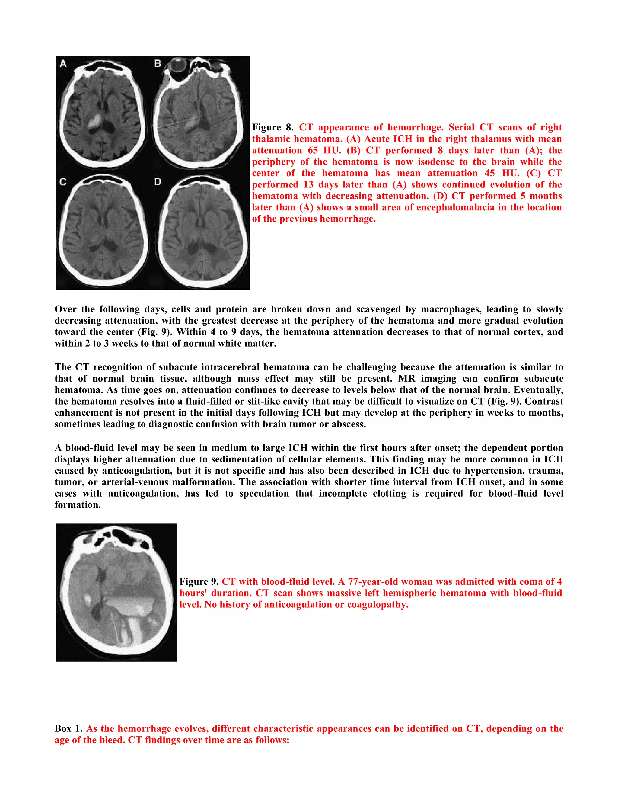 Case record...Cerebral amyloid angiopathy (CAA), | PDF