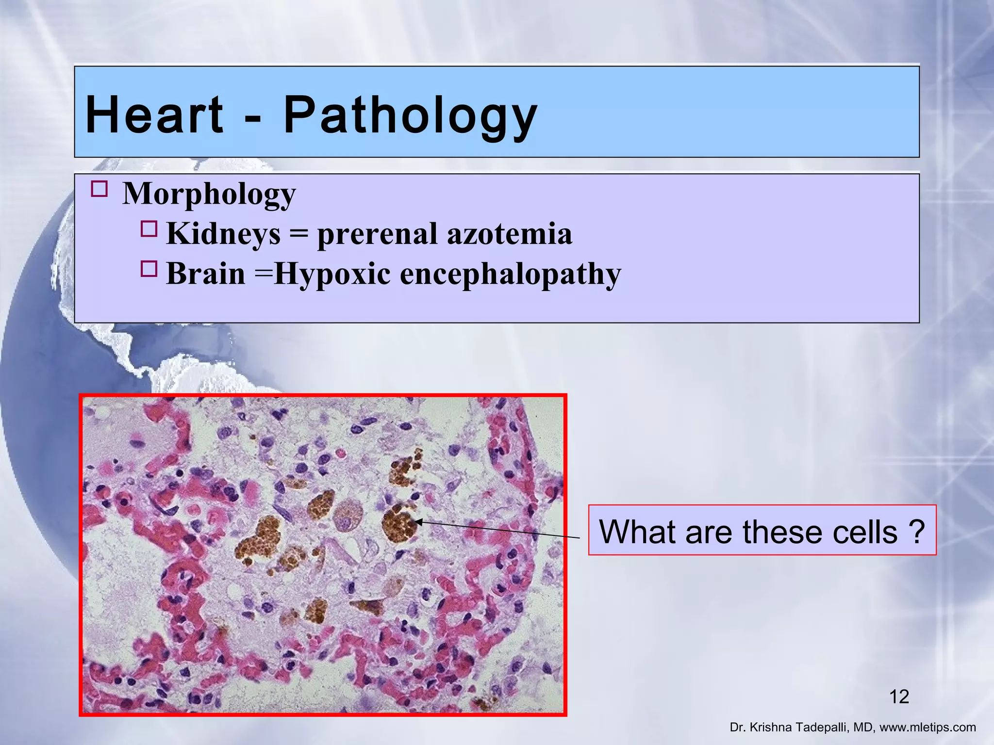 Pathology Of Heart Failure Pdf – Heart Failure Symptoms Pdf – CIAHJD