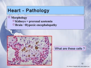 Heart Failure Cells