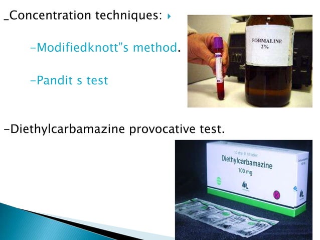 filariasis | PPTX | Infectious Diseases | Diseases and Conditions