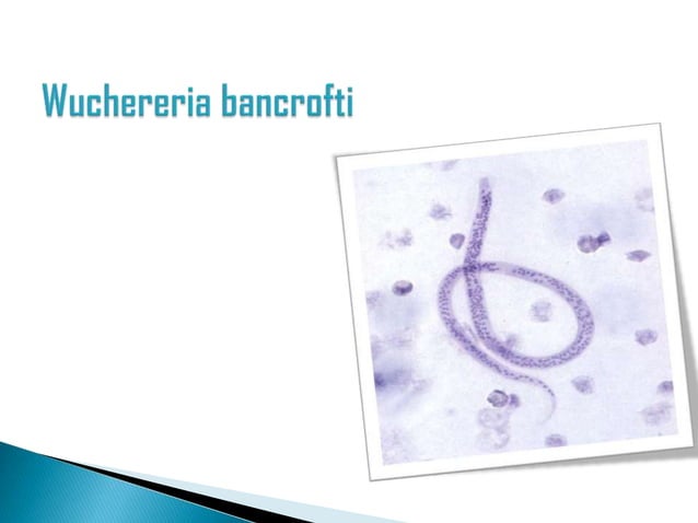 filariasis | PPTX | Infectious Diseases | Diseases and Conditions