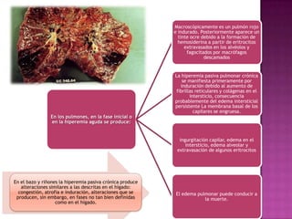 hiperemia | PPTX