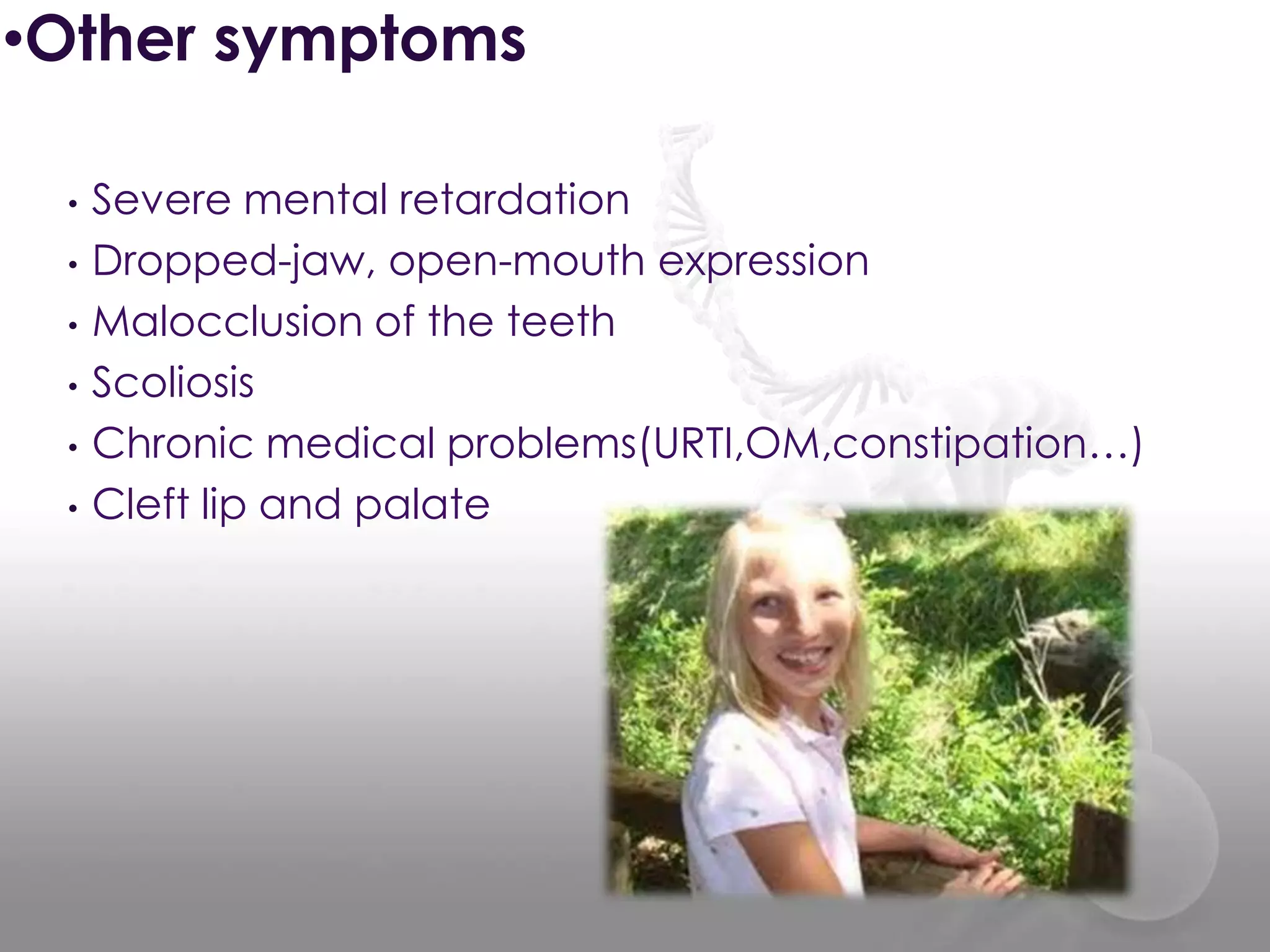 Cat's cry syndrome & Prader willi syndromes | PPTX