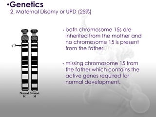 Cat's cry syndrome & Prader willi syndromes | PPTX