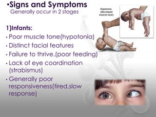 Cat's cry syndrome & Prader willi syndromes | PPTX