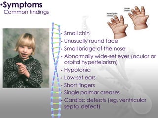 Cat's cry syndrome & Prader willi syndromes | PPTX