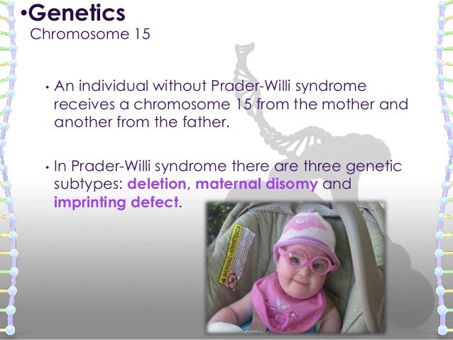 Cat's cry syndrome & Prader willi syndromes