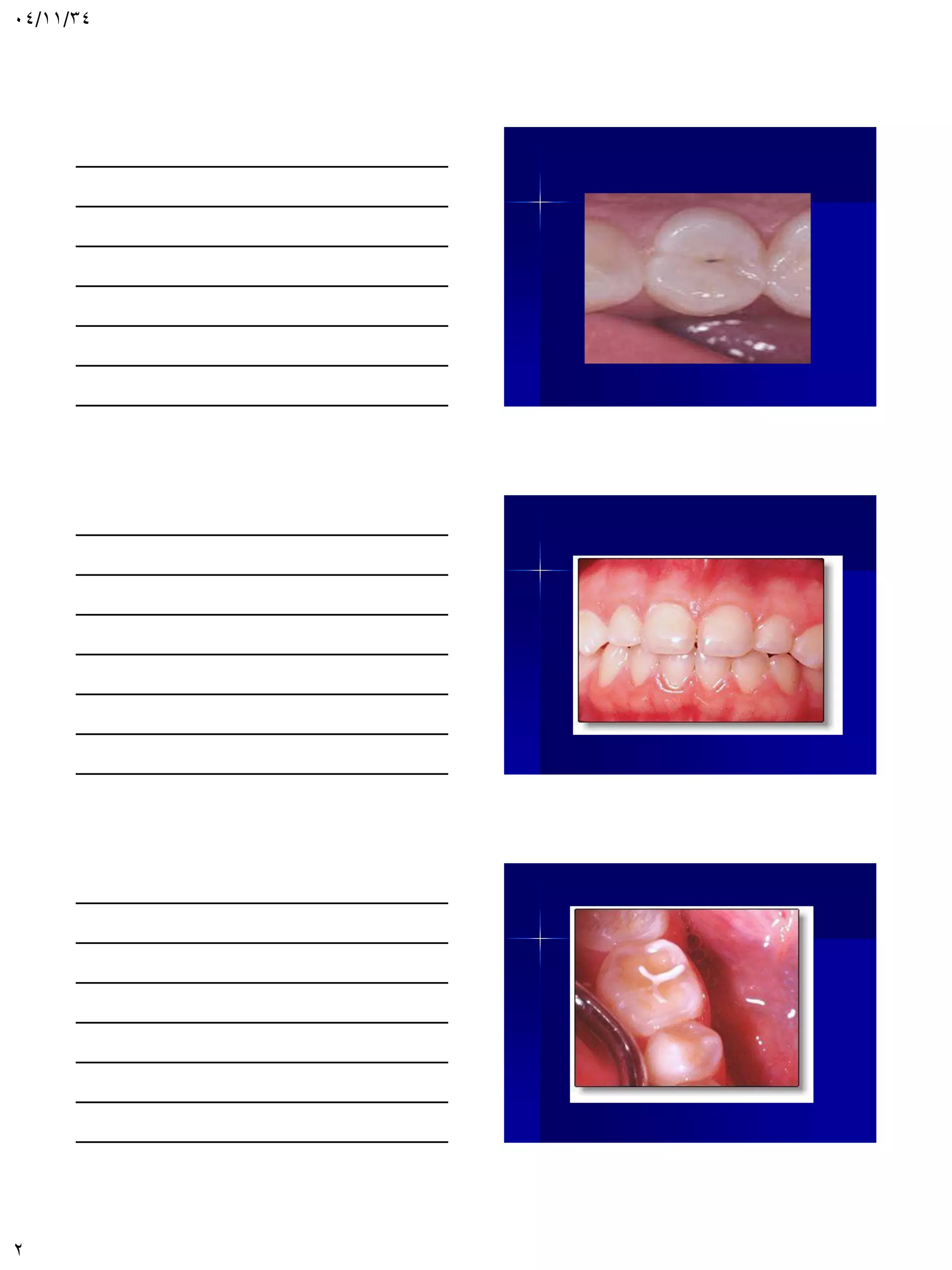 introduction to operative dentistry | PDF