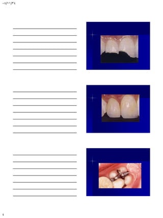 introduction to operative dentistry | PDF
