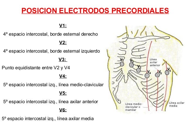 25. ECG
