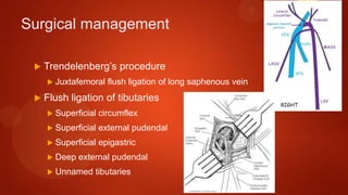 varicose veins | PPTX