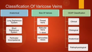 varicose veins | PPT