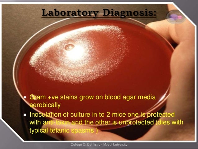 Clostridium species - Microbiology