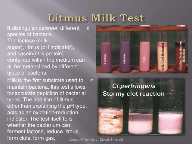Clostridium species - Microbiology