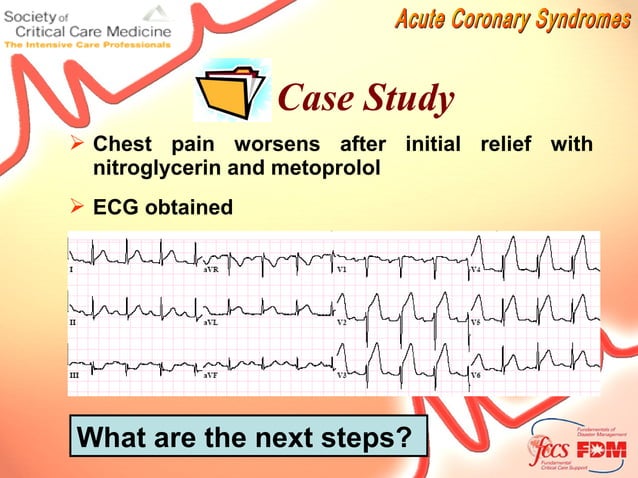 Acute coronary syndrome management | PPT