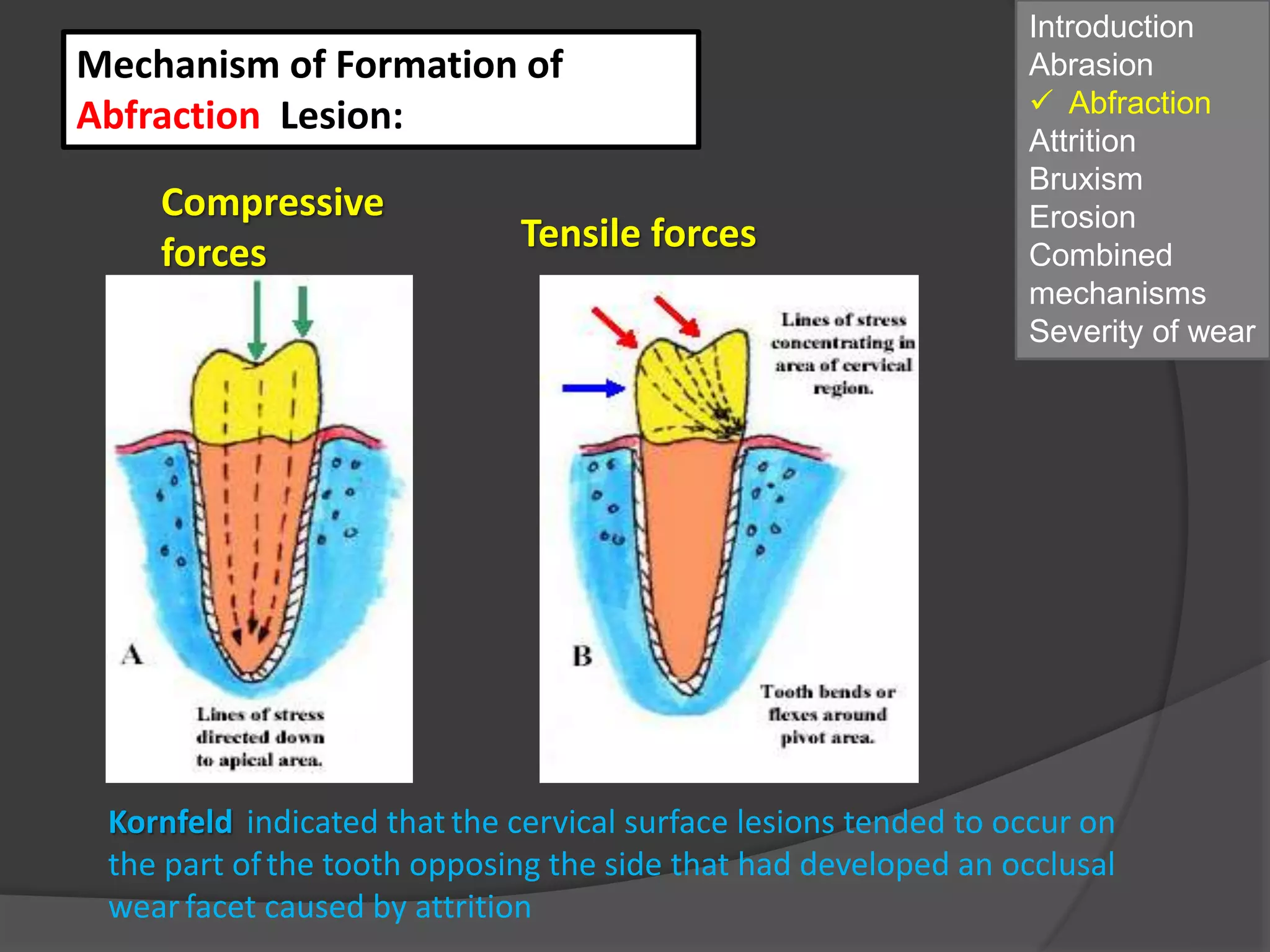 Restorative management of worn dentition (PART 1)- AETIOLOGY | PPTX