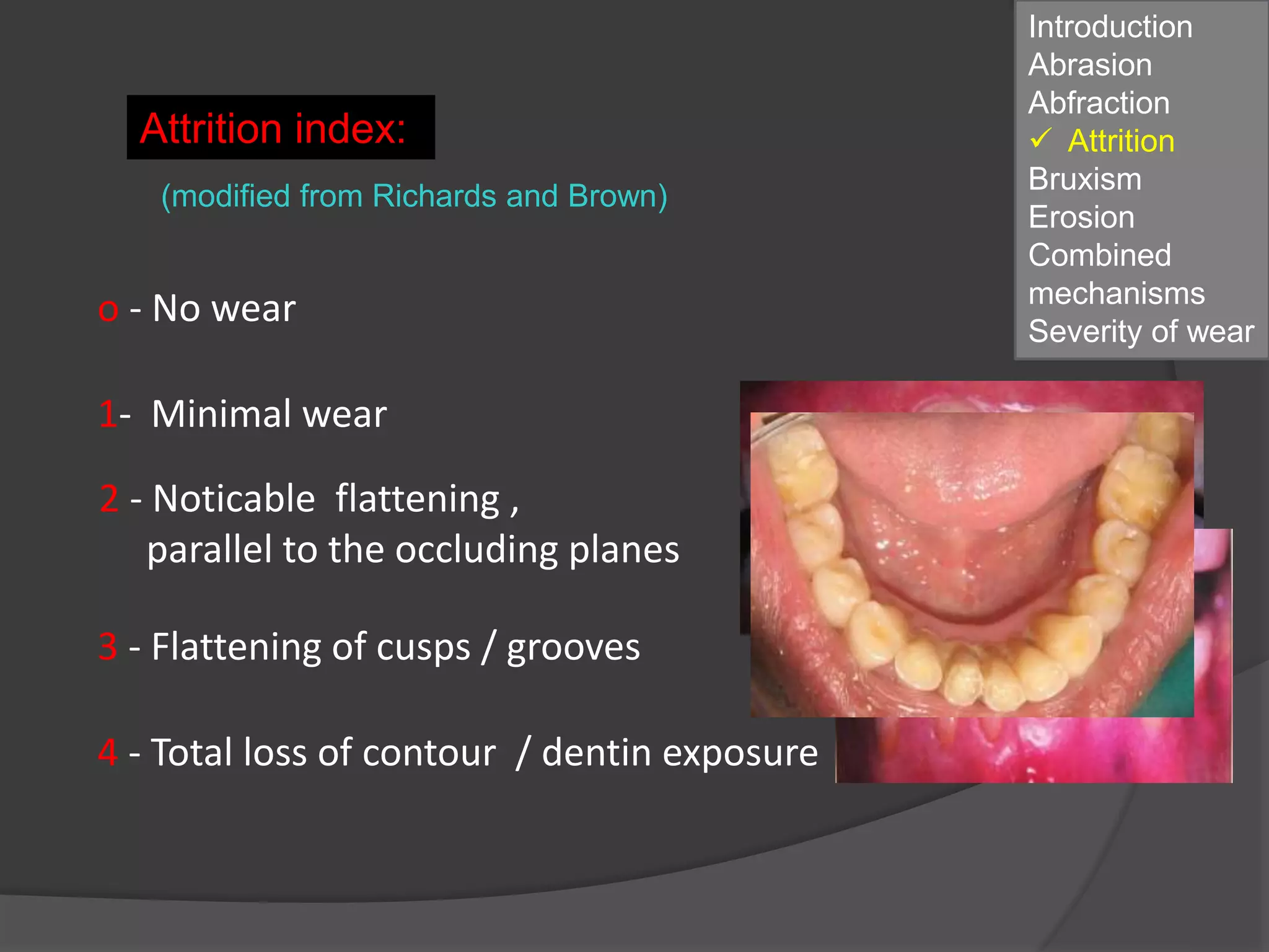 Restorative management of worn dentition (PART 1)- AETIOLOGY | PPTX