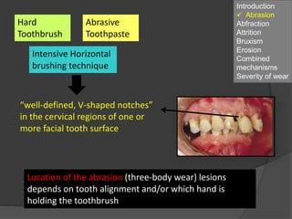 Restorative management of worn dentition (PART 1)- AETIOLOGY | PPTX