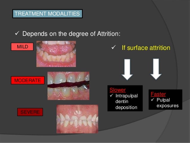 Restorative management of worn dentition (PART 1)- AETIOLOGY