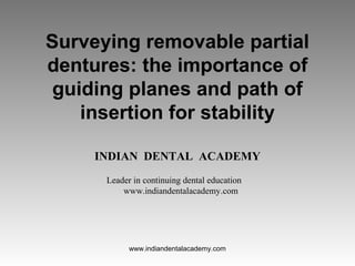 Guiding Planes and Path Insertion Critical RPD Stability | PPT
