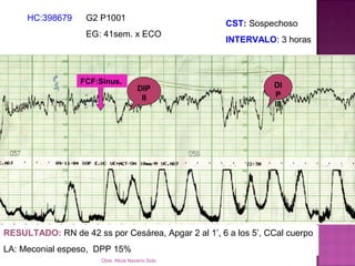 1. fisiopatologia del dip[1] | PPT