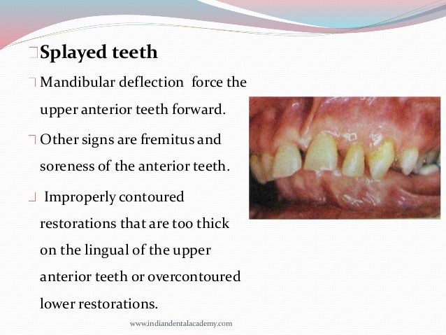 full mouth rehabilitation / Labial orthodontics