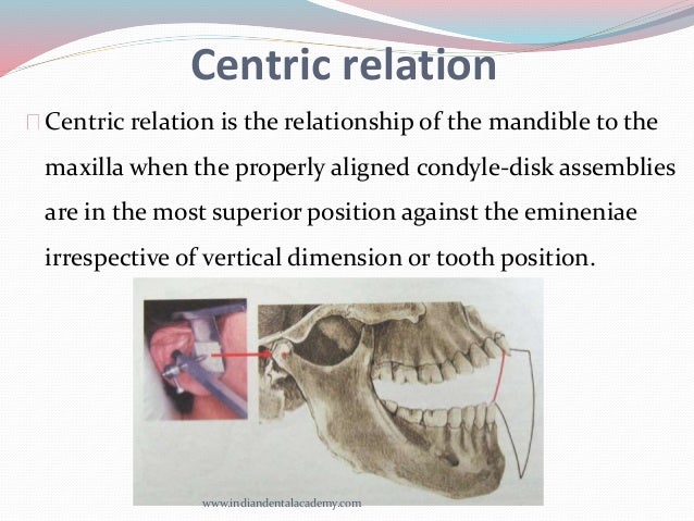 full mouth rehabilitation / Labial orthodontics
