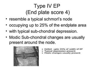 End plate damage score (SPINE 2010) | PPT