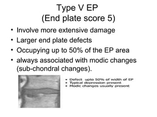 End plate damage score (SPINE 2010) | PPT