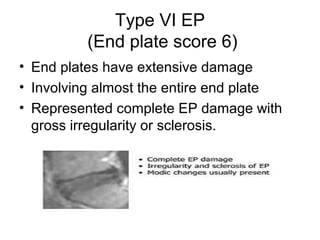 End plate damage score (SPINE 2010) | PPT