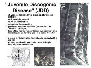 End plate damage score (SPINE 2010) | PPT