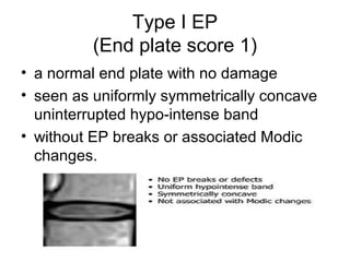 End plate damage score (SPINE 2010) | PPT