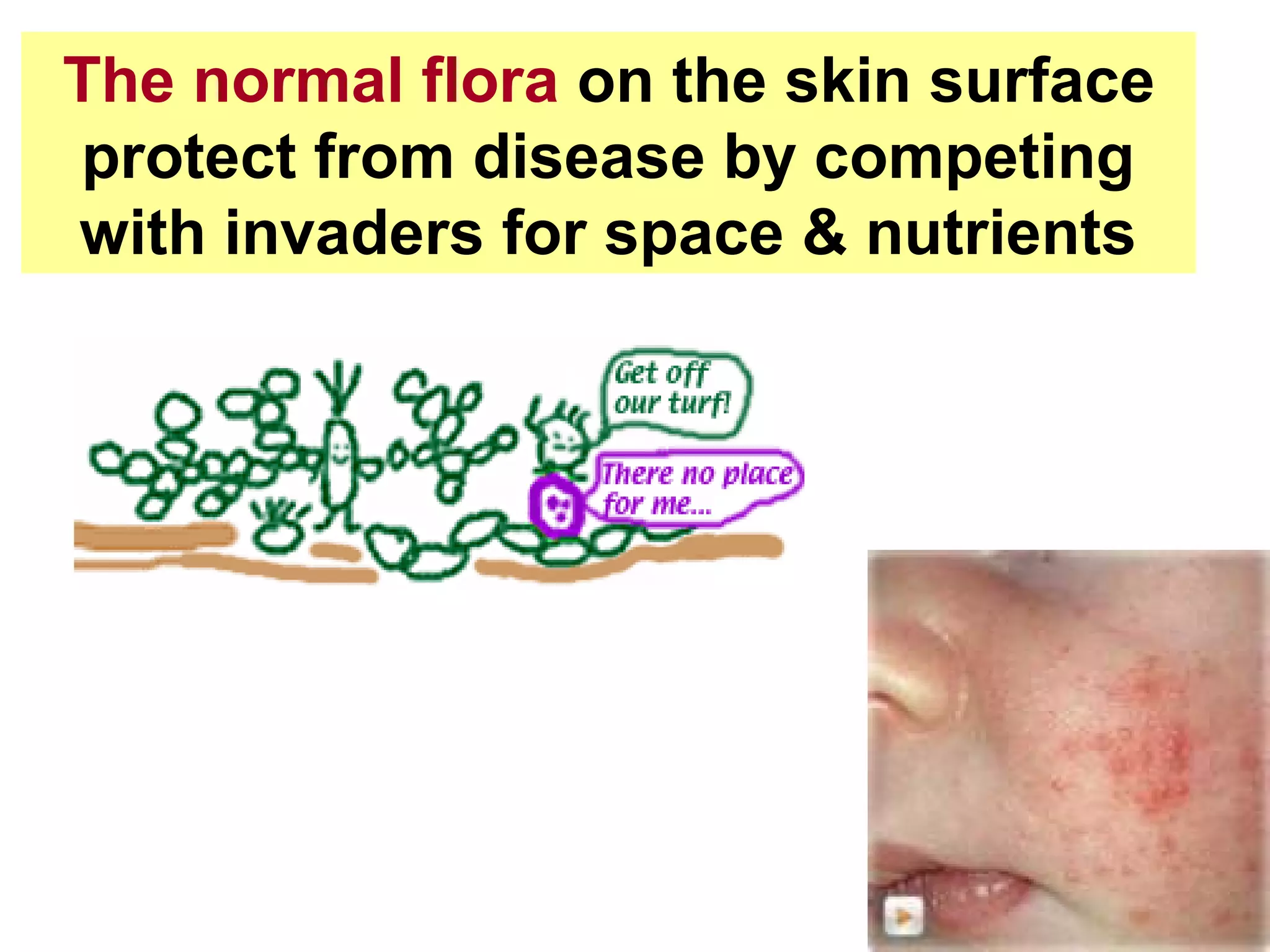 BIOLOGY FORM 5 CHAPTER 1 - 1.5 BODY DEFENCE MECHANISM | PPT