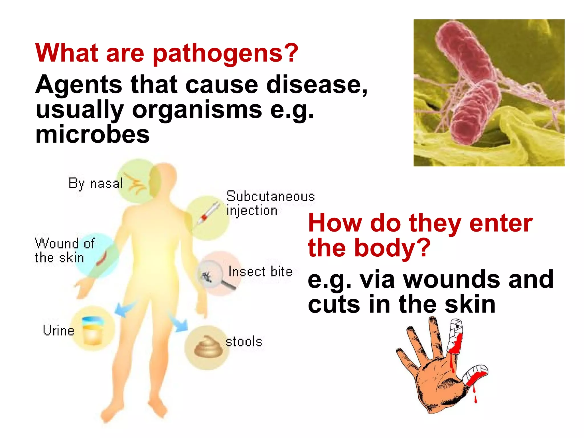 BIOLOGY FORM 5 CHAPTER 1 - 1.5 BODY DEFENCE MECHANISM | PPT