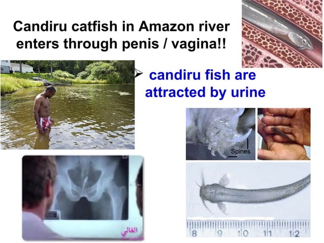 BIOLOGY FORM 5 CHAPTER 1 - 1.5 BODY DEFENCE MECHANISM | PPT | Skin and ...