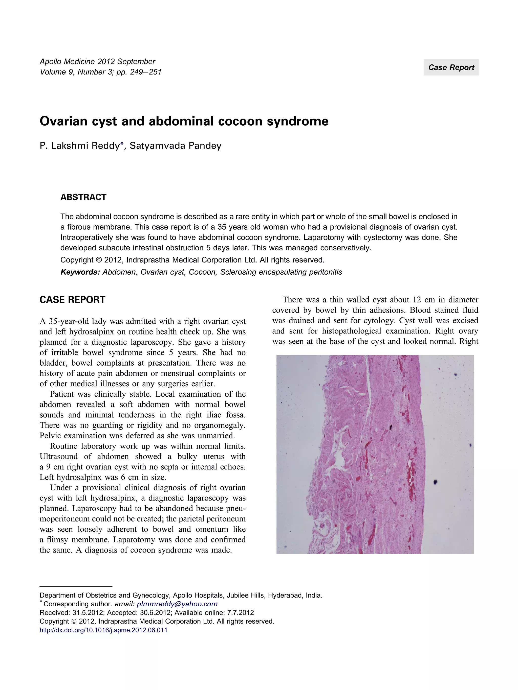 Ovarian cyst and abdominal cocoon syndrome | PDF