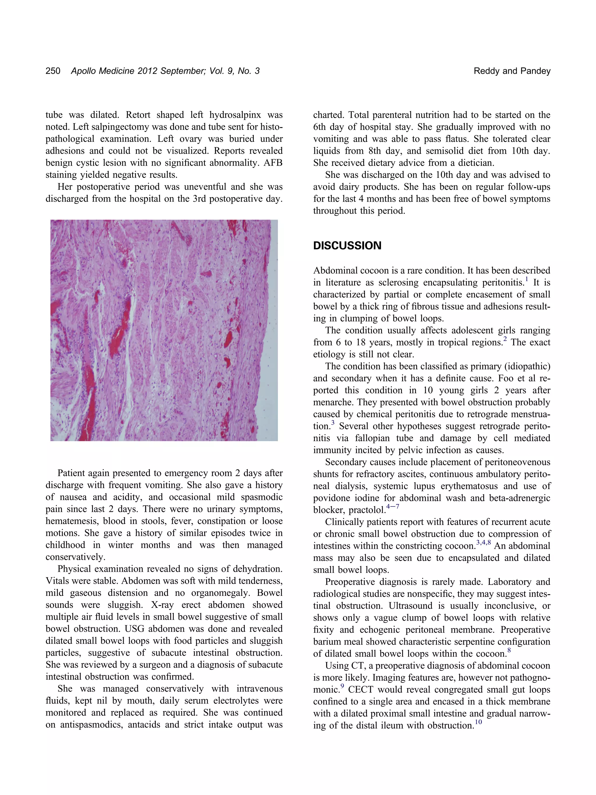 Ovarian cyst and abdominal cocoon syndrome | PDF