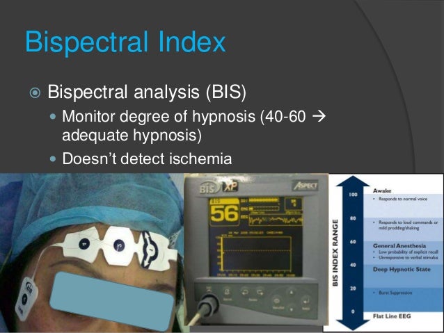 neurophysiologic monitoring final