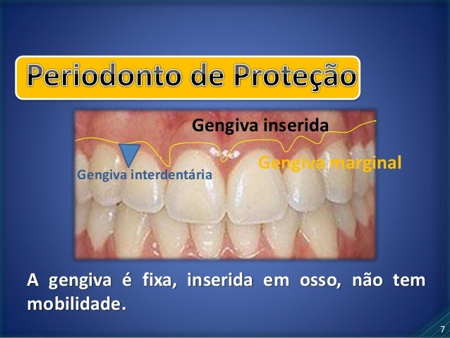 doença periodontal