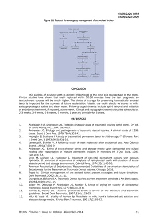 Replantation of Avulsed Permanent Anterior Teeth: A Case Report. | PDF