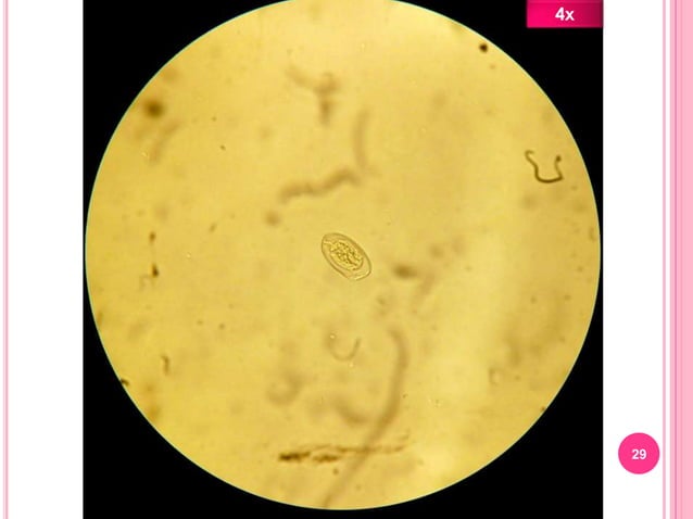 Enterobius vermicularis