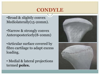 TEMPOROMANDIBULAR JOINT | PPTX