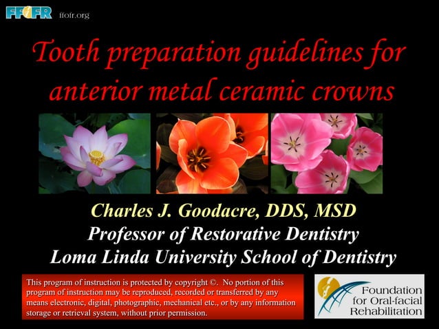 1.anterior mcc prep | PDF | Dental Health | Diseases and Conditions