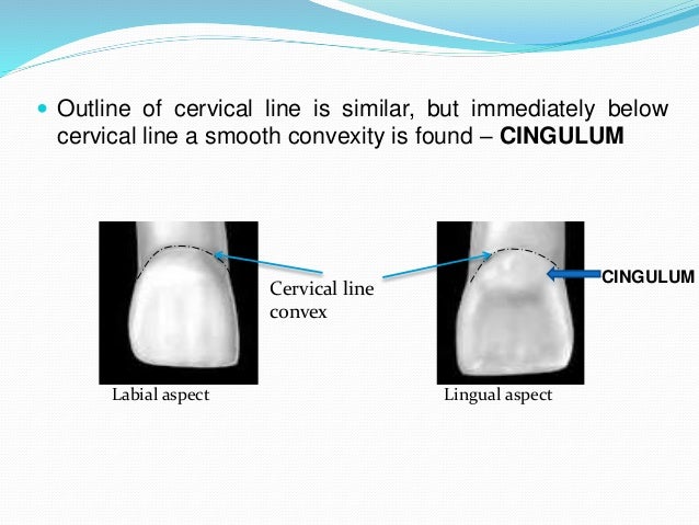 Permanent Maxillary Central Incisor