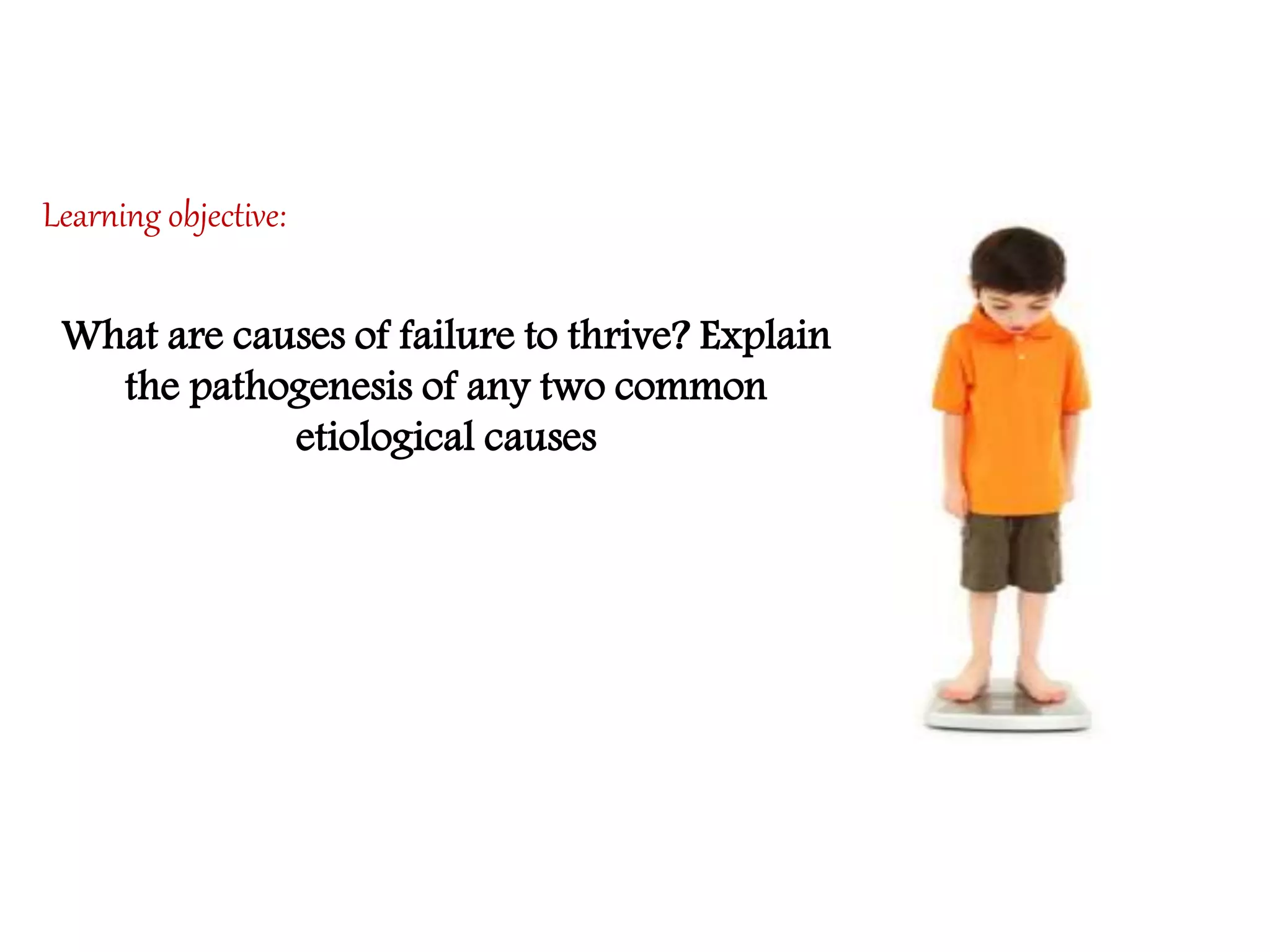 Failure to thrive (FTT) | PPT