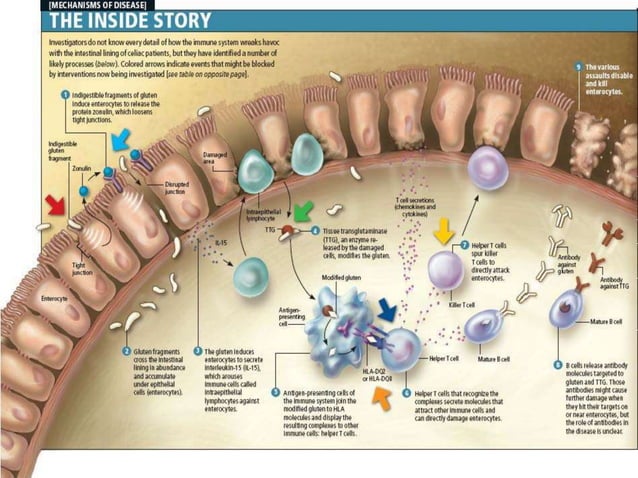 Failure to thrive (FTT) | PPTX