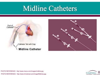 1. peripheral and midline iv lines
