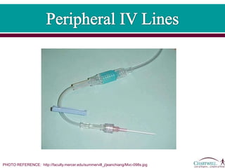 Peripheral Intravenous Line